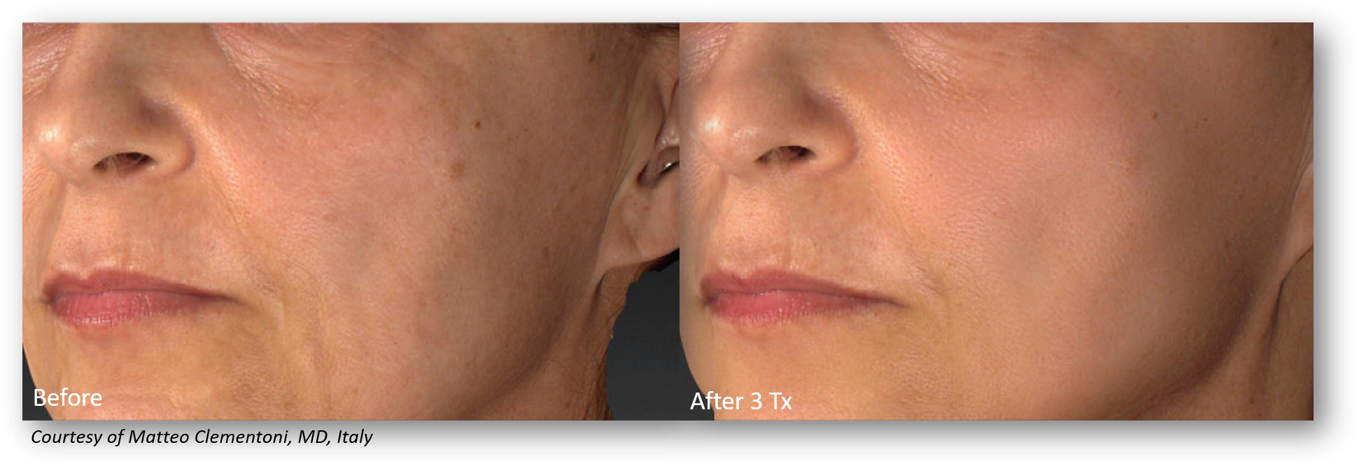 Total Skin Solution – SkinOvations
